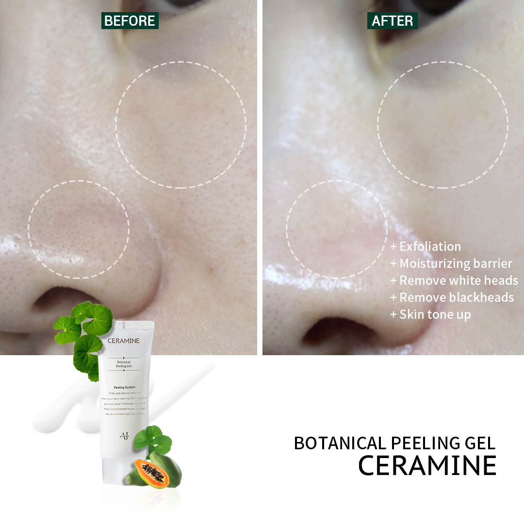 Botanical O2 Peeling Gel (70ml) - Ceramine Malaysia